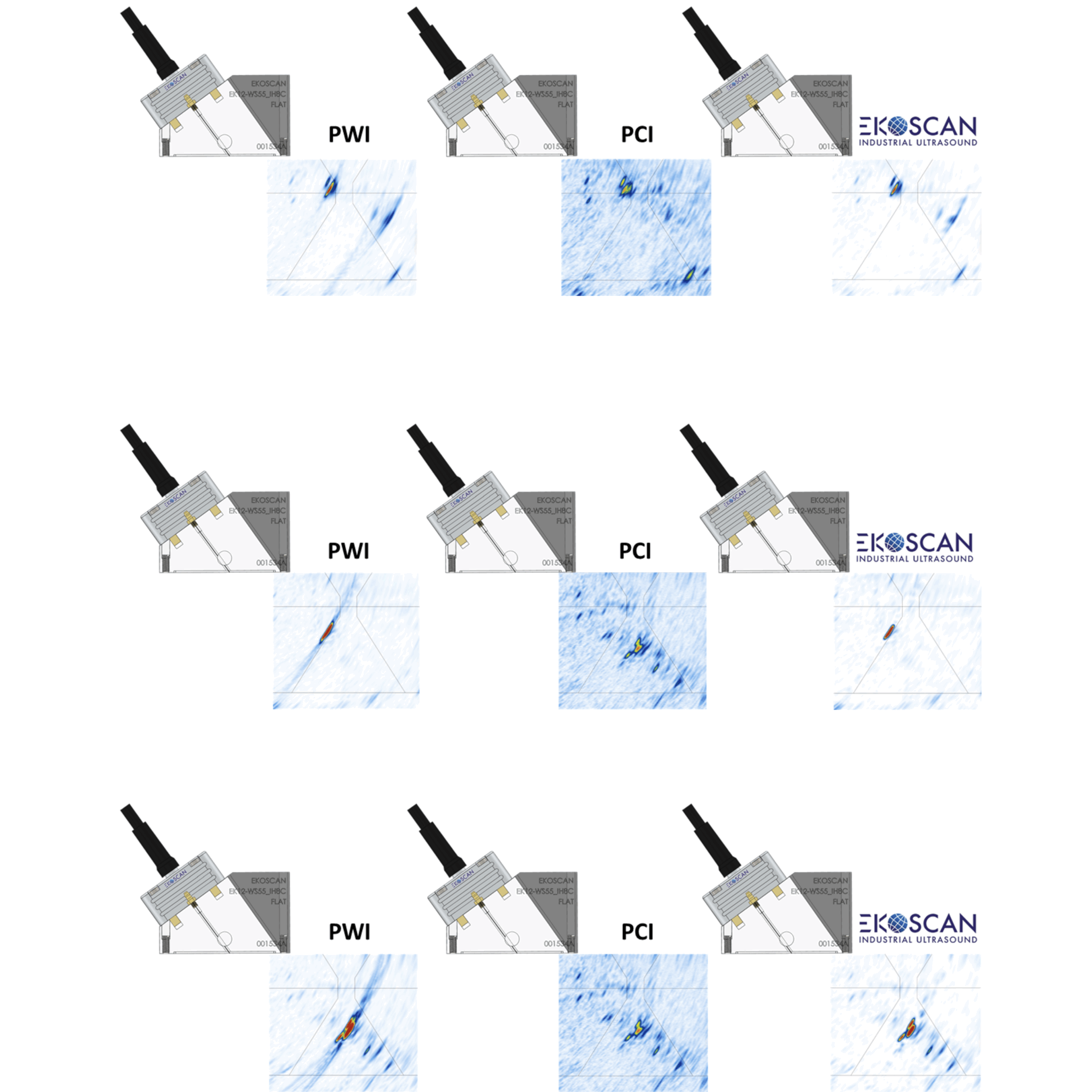 WAND - Ultrasound Imaging | Ekoscan