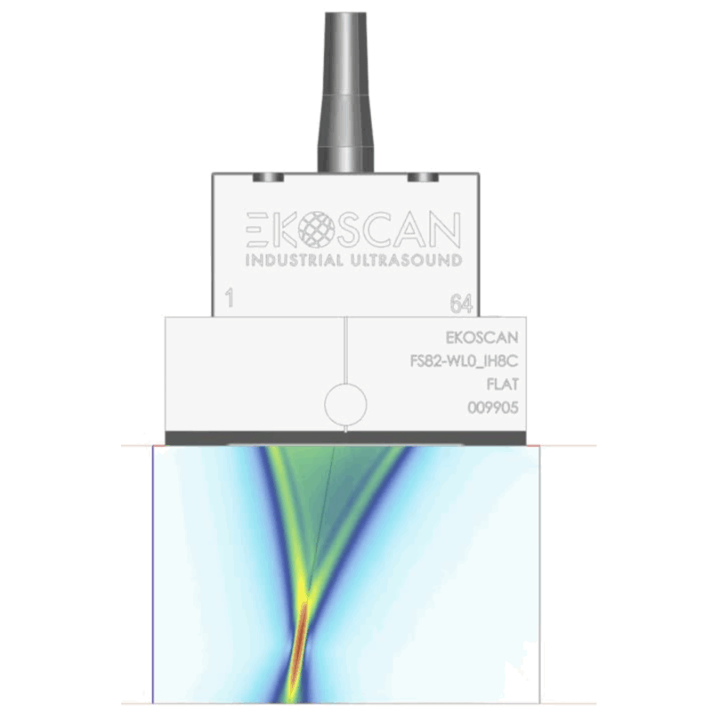Ultrasound Imaging - Ekoscan